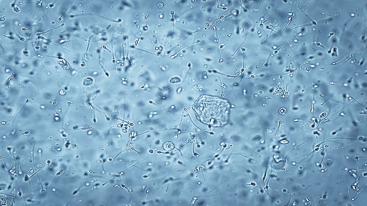 Asthenozoospermia - Urology center Vienna
